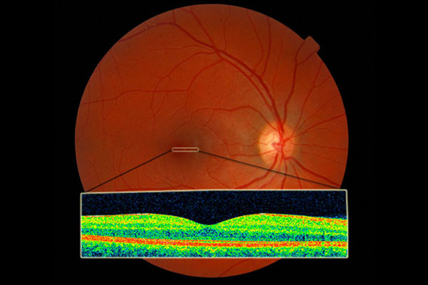 Eye care services – Springfield Lakes Eyecare